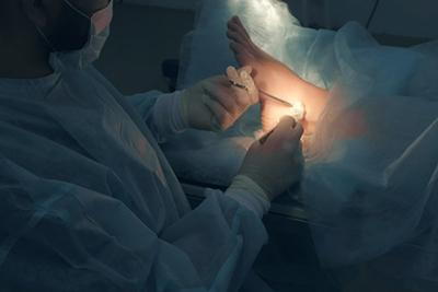 Minimally Invasive Ankle Surgery: Is It Right for You?