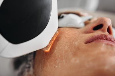 Is IPL Treatment Right for You? Understanding the Benefits and Risks