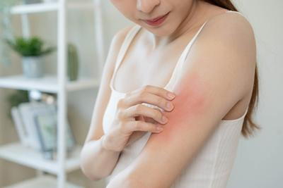 Identifying the Most Common Types of Skin Rashes