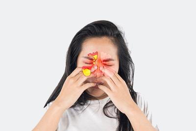 Understanding and Treating Chronic Sinus Infections