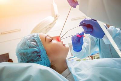 How to Tell If You Need Sinus Surgery