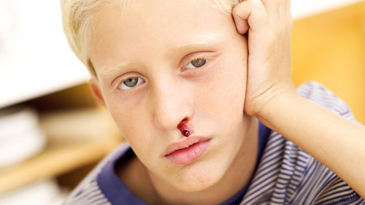 Epistaxis in Children: Causes, Treatment & When to Seek Care
