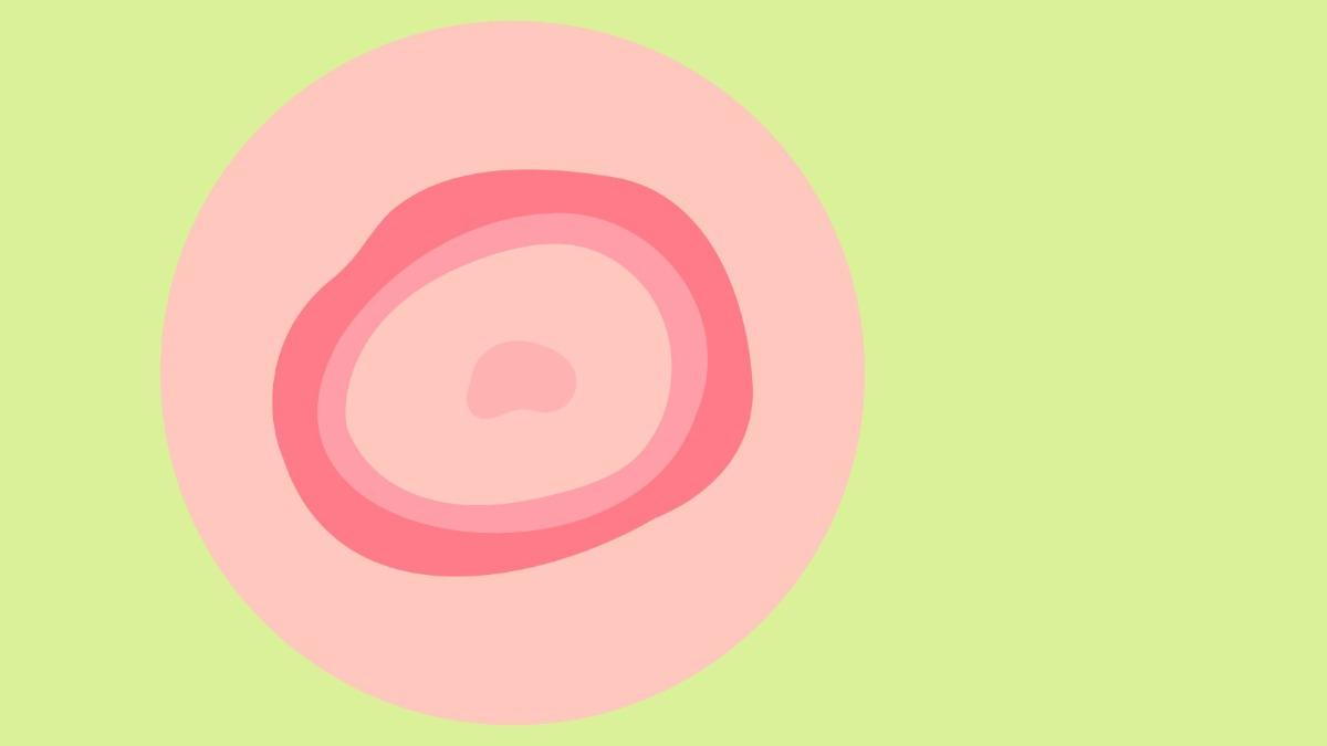 5 Signs of Ringworm You Should Never Ignore