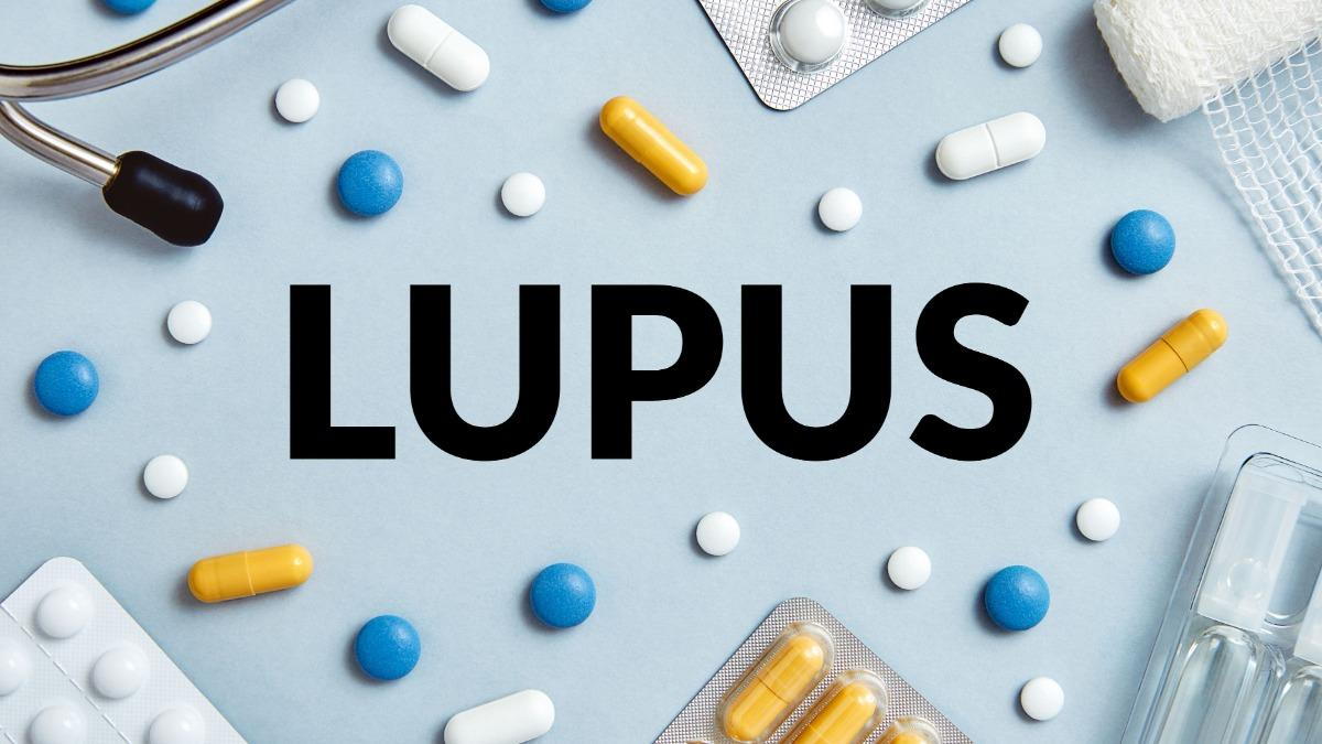Juvenile Lupus in Kids: Early Signs & Treatment Guide