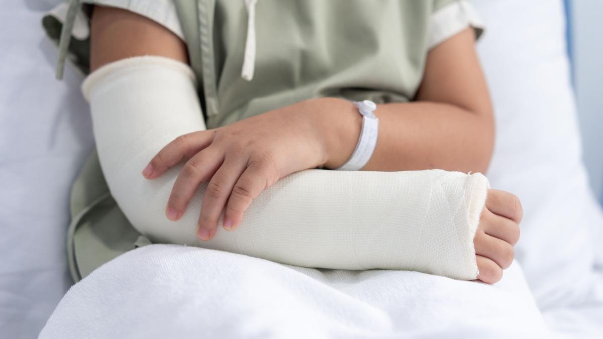 Pediatric Fracture Types and How They're Treated