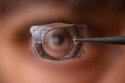 What Are Lens Implants and How Do They Work?