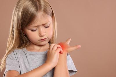 Allergic Reaction Rashes in Children: Symptoms, Treatment & Prevention
