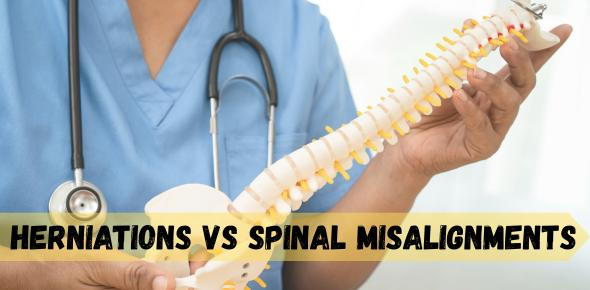Herniations vs Spinal Misalignments