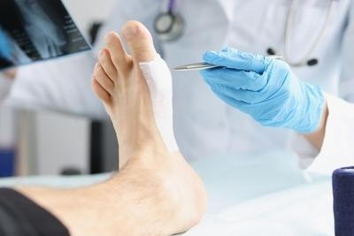 Common Foot Conditions That May Require Surgical Treatment