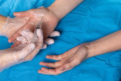 What is Hyperhidrosis? Understanding Excessive Sweating and Its Causes