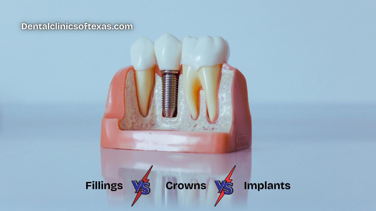 Fillings vs Crowns vs Implants: Which Dental Option Fits You?