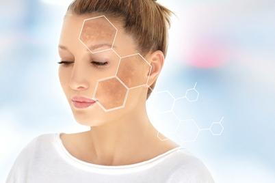 Understanding Hyperpigmentation: Causes, Types, and Treatments