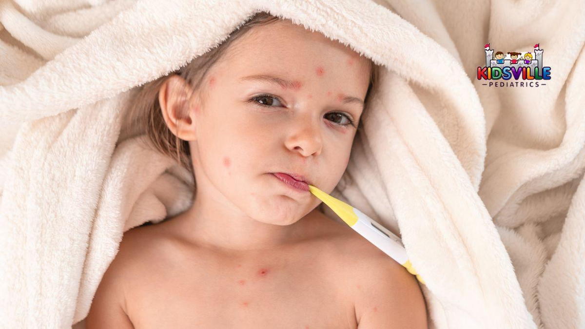 Monkeypox Guide: Symptoms & Prevention | Mansfield Pediatrics