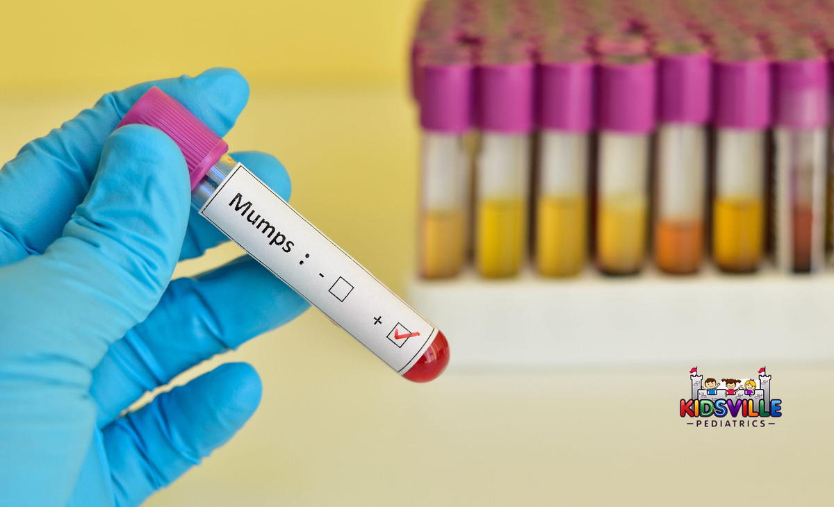 Southlake Pediatrician Shares 5 Key Mumps Signs Parents Should Know