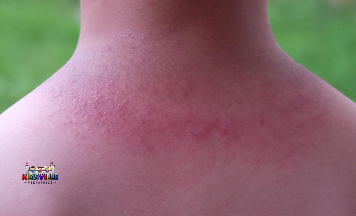 Summer Skincare Tips for Babies and Toddlers