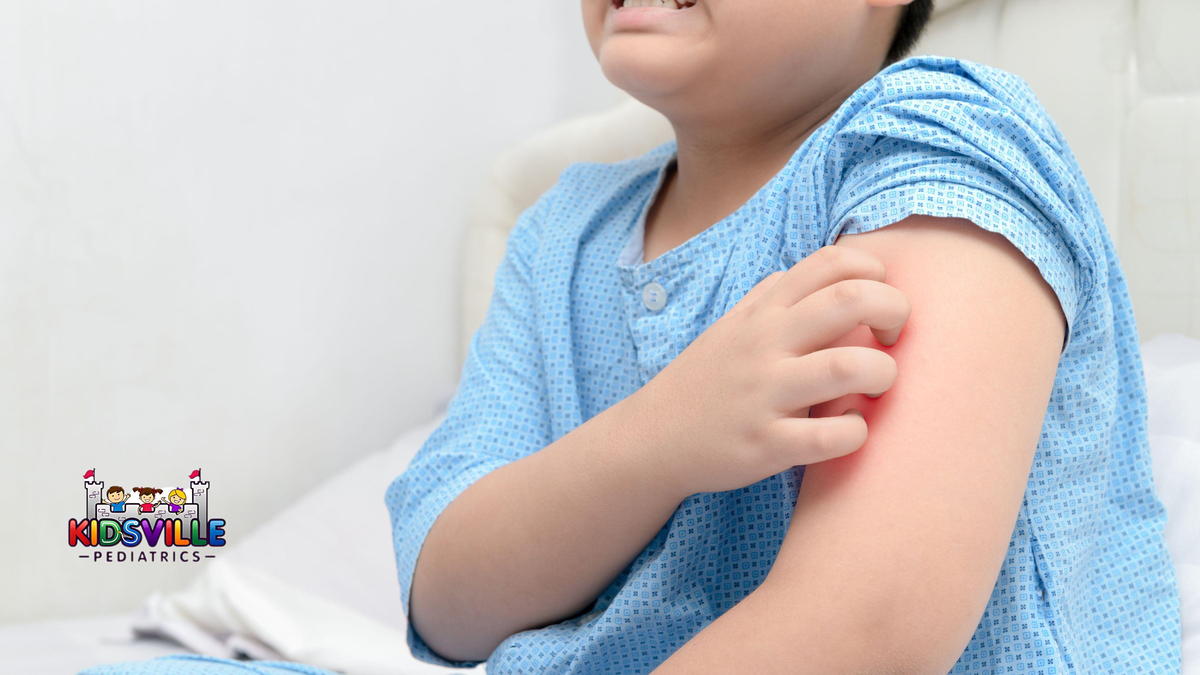 Shingles in Children: 10 FAQs Parents Need to Know