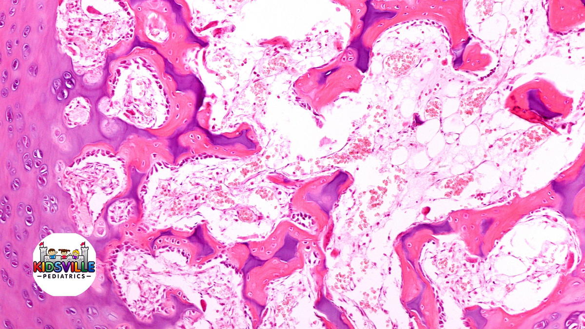 10 Health Risks Kids Face from Junk Food