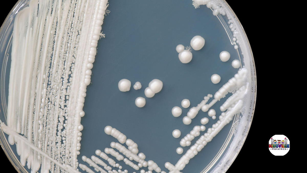 Infant Oral Thrush: Signs, Causes & Treatment Tips