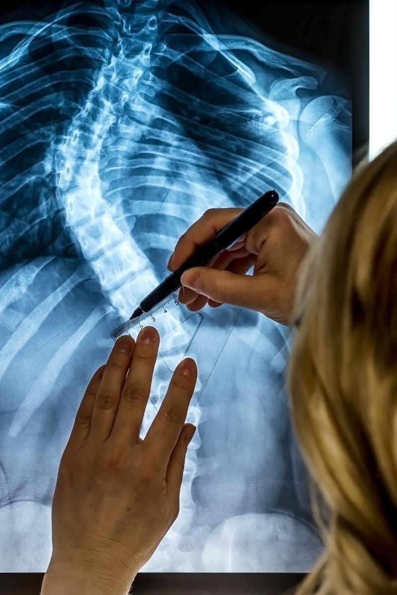 What am I doing to cause my ribs to come out of alignment? Gallatin ...